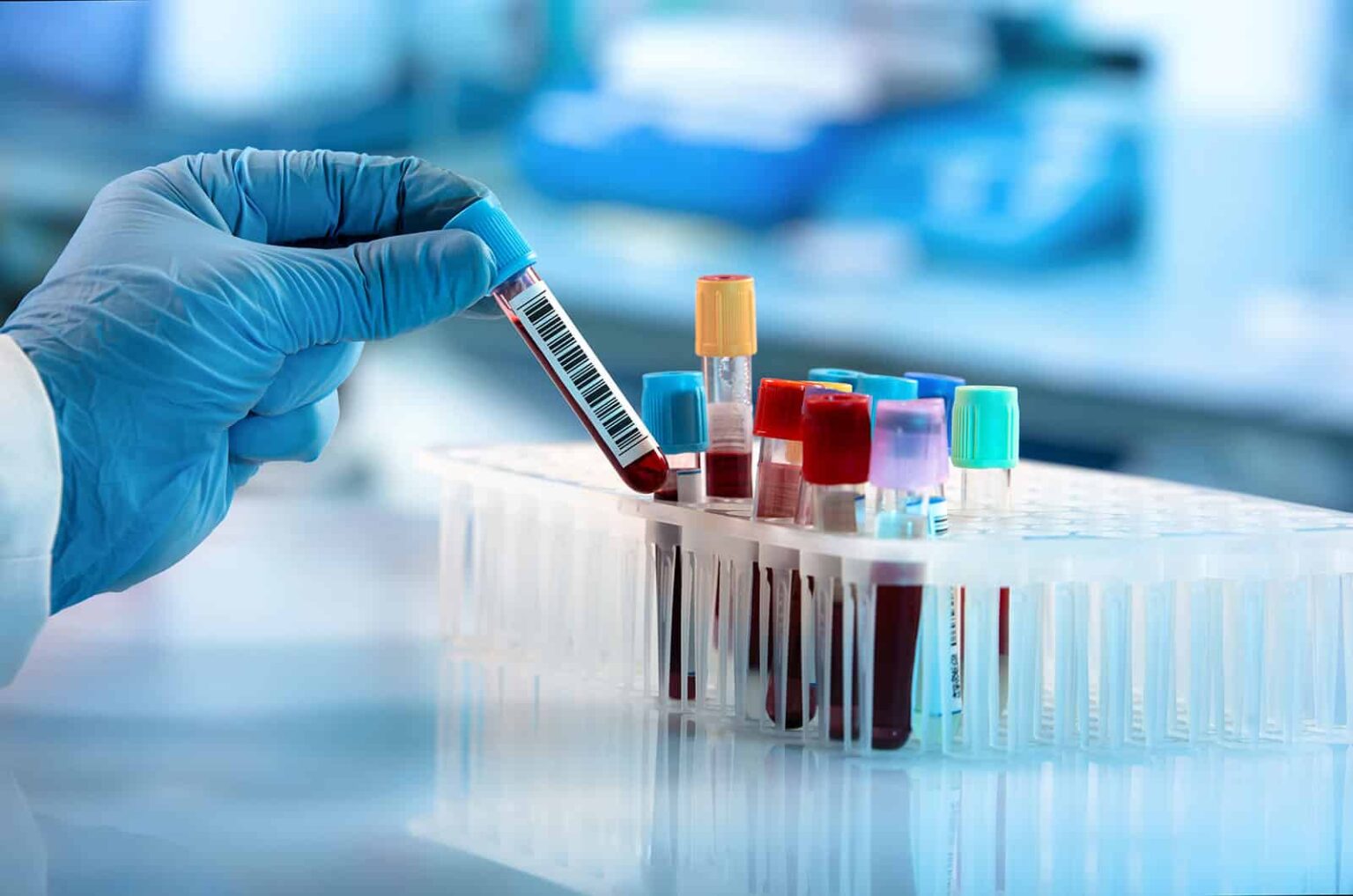 How Far Back Does a Lab Urine Test Go? - Site